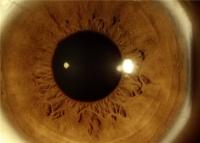 China 10 Times Magnification 16MP Ophthalmology Equipment for sale
