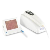 China Handheld Dermatoscope Facial Skin Moisture And Oil Analyzer Wifi Scalp Analyzer for sale