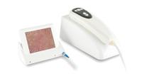 China Wifi Skin And Scalp Tester Wireless Skin Analyser Digital With 8