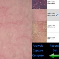 China Wifi Skin And Scalp Tester Wireless Skin Analyser Digital With 8