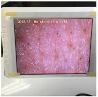 China White Wifi Skin Moisture Checker Skin Moisture Sensor With Photo Displaying In Ipad for sale