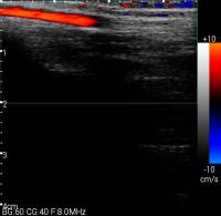 China USB Color Handheld Ultrasound Scanner , Portable Ultrasound Device Lightweight for sale
