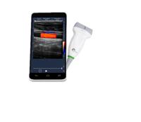 China Wifi Handheld Ultrasound Scanner Diagnostic System With Frequency Of 2~10mhz for sale
