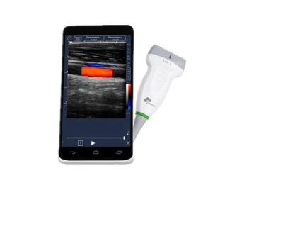 China Wifi Handheld Ultrasound Scanner Diagnostic System With Frequency Of 2~10mhz for sale