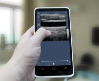 China Wifi Handheld Ultrasound Scanner Diagnostic System With Frequency Of 2~10mhz for sale