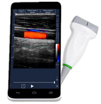 China Mobile Full Digital Portable Ultrasound Machine Wireless With 6 Inch LCD Touch Screen for sale