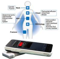 China Portable Pocket Color Doppler Handheld Ultrasound Scanner For All Kinds Of Application for sale
