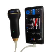 China Diagnostic Handheld Ultrasound Scanner Equipment Wireless With 8 TGC Adjustments for sale