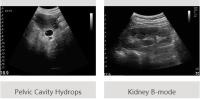 China Compact Digital Portable Mobile Ultrasound Scanner Supported Andriod And Window for sale