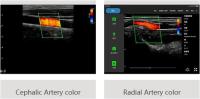 China Compact Digital Portable Mobile Ultrasound Scanner Supported Andriod And Window for sale
