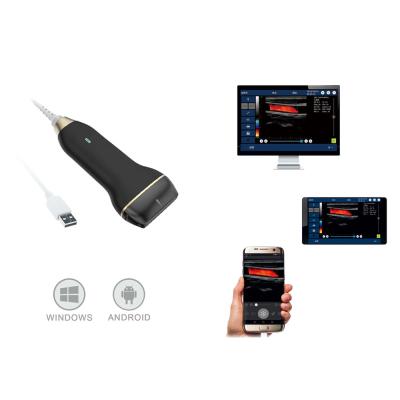 China Compact Digital Portable Mobile Ultrasound Scanner Supported Andriod And Window for sale