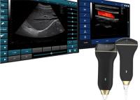 China USB Ultrasonic Transducer Probe Handheld Ultrasound Scanner Wireless Only 150g Weight for sale