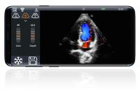 China Wireless Color Handheld Ultrasound Probe Scanner Digital Ultrasound Cardiac Transducer for sale