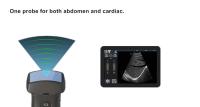 China Mobile Hand Ultrasound Machine Ultrasonication Probe Supported Windows / Android / IOS for sale