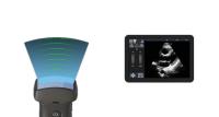 China Mobile Hand Ultrasound Machine Ultrasonication Probe Supported Windows / Android / IOS for sale