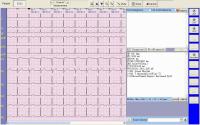 China Touch Display , 12 Leads ECG Monitoring System 12 Channel Format Recording for sale