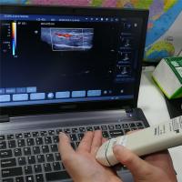 China Portable Color Doppler Machine Handheld Ultrasound Scanner With Frequency 2~11MHz for sale