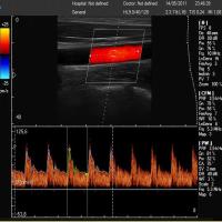 China Light Portable 3D Handheld Doppler Ultrasound Machine With 15