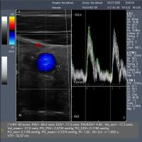 China Light Portable 3D Handheld Doppler Ultrasound Machine With 15