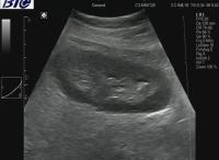 China LED Screen Laptop Color Doppler Ultrasound Scanner Device With USB Storage for sale