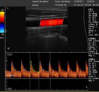 China LED Screen Laptop Color Doppler Ultrasound Scanner Device With USB Storage for sale