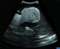 China Portable Color Doppler Ultrasound Machine With Measurements And Calculations Software for sale
