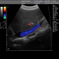 China Portable Color Doppler Ultrasound Machine With Measurements And Calculations Software for sale