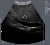 China 3d Color Doppler Ultrasound Scanner / Hand Held Doppler With Built - In Battery for sale