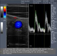China 3d Color Doppler Ultrasound Scanner / Hand Held Doppler With Built - In Battery for sale