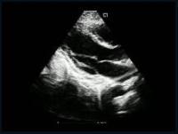 China Mutil Language Fetal Color Doppler Ultrasound Scanner With Micro - Convex Probe for sale