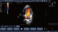 China Mutil Language Fetal Color Doppler Ultrasound Scanner With Micro - Convex Probe for sale
