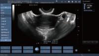 China Transvaginal Probe Color Doppler Ultrasound Scanner , Handheld Doppler Pregnancy for sale
