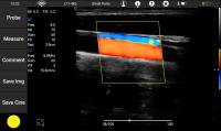 China Mobile Color Doppler Ultrasound System Compatible To Windows / Android / IOS for sale