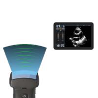 China 2 -11MHz Hand Held Color Doppler Ultrasound Scanner Like A Mobile Phone for sale