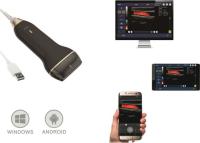 China USB Port Home Color Doppler Ultrasound Scanner With 5~10 MHz Frequency for sale
