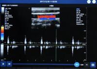 China USB Port Home Color Doppler Ultrasound Scanner With 5~10 MHz Frequency for sale