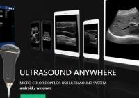 China USB Port Home Color Doppler Ultrasound Scanner With 5~10 MHz Frequency for sale