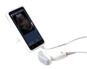China High Resolution Portable Doppler Ultrasound Machine With 6 Inch Full Touch Screen for sale