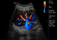 China High Resolution Portable Doppler Ultrasound Machine With 6 Inch Full Touch Screen for sale