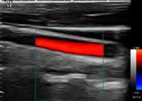 China Andriod Color Doppler Ultrasound Scanner , Hand Held Doppler Machine Only 550g Weight for sale