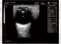 China Digital Ultrasound Machine Portable Black and White Ultrasound Scanner in Four Languages for sale