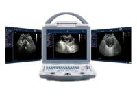 China Hospital Ultrasound Machine Portable Ultrasound Scanner with Dual Probe Connectors for sale