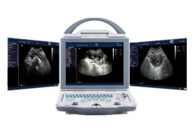 China Hospital Ultrasound Machine Portable Ultrasound Scanner with Dual Probe Connectors for sale
