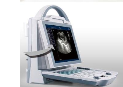China Home Ultrasound Machine Portable Ultrasound Scanner with Only 4.5kgs Weight for sale