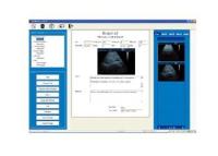 China Home Ultrasound Machine Portable Ultrasound Scanner with Only 4.5kgs Weight for sale