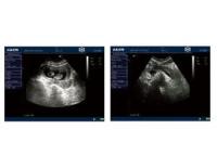 China Home Ultrasound Machine Portable Ultrasound Scanner with Only 4.5kgs Weight for sale