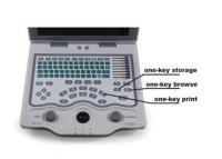 China Home Ultrasound Machine Portable Ultrasound Scanner with Only 4.5kgs Weight for sale