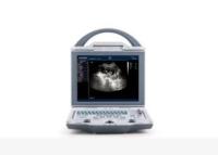 China Mobile Ultrasound Scanner Portable Ultrasound Scanner with Transvaginal Linear Convex Probe for sale