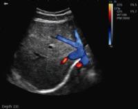 China Digital Color Doppler Portable Ultrasound Equipment With PW CFM THI Mode for sale
