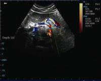 China Digital Color Doppler Portable Ultrasound Equipment With PW CFM THI Mode for sale